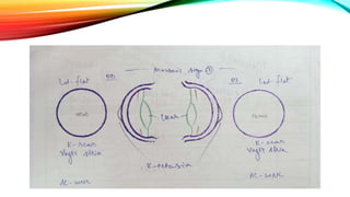 Scleral contact lens Case presentations kunj | PPTX
