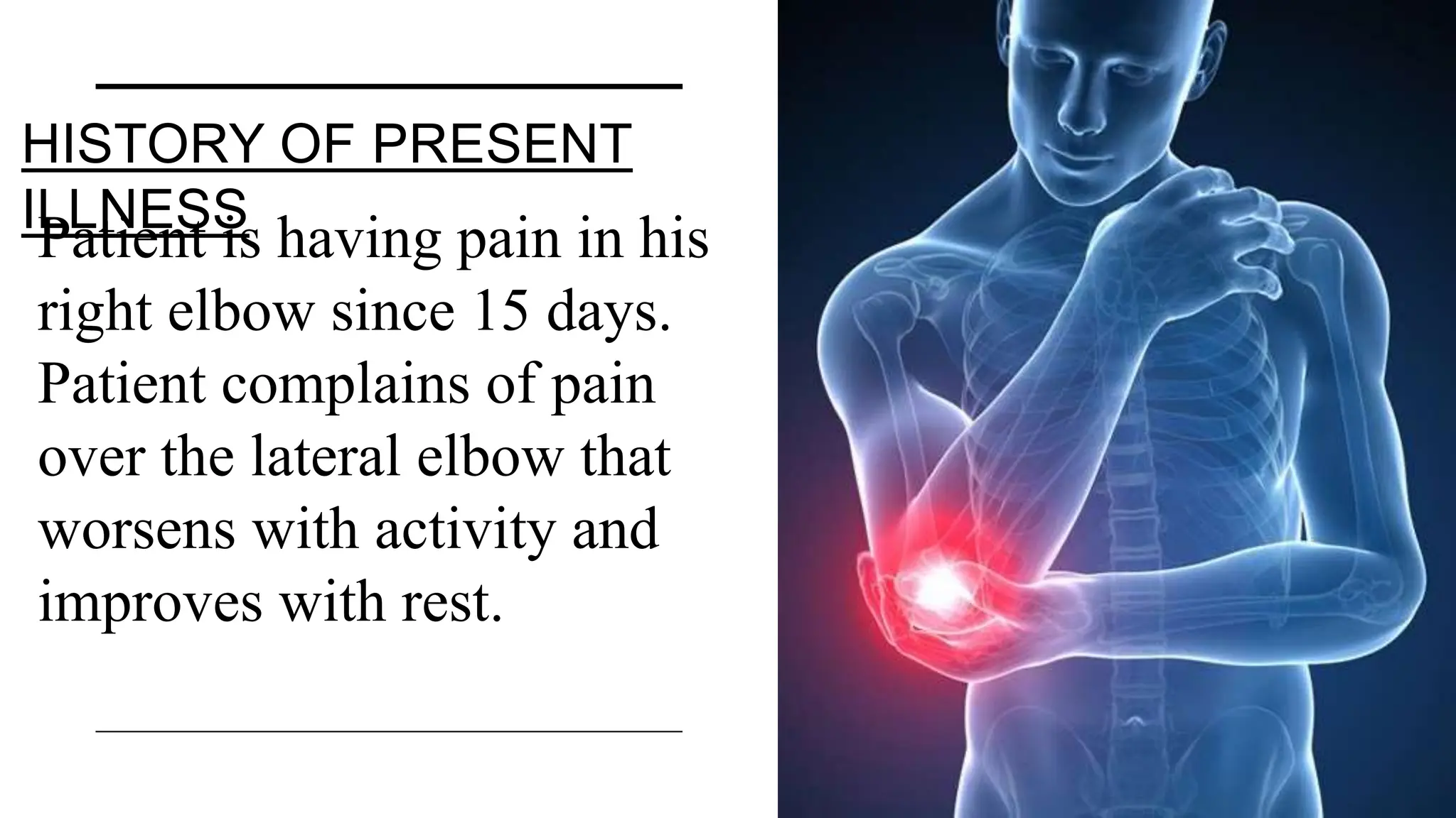 Case presentation tennis elbow. With detailed assessment | PPTX