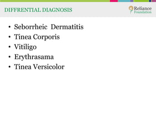 Case presentation Tinea versicolor | PPTX