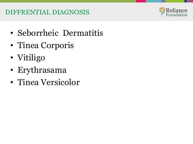 Case presentation Tinea versicolor