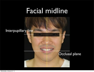 Casepresentgivenpdf | PDF