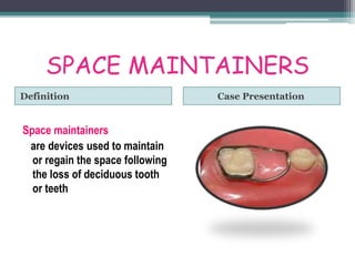Space Maintainer | PPTX