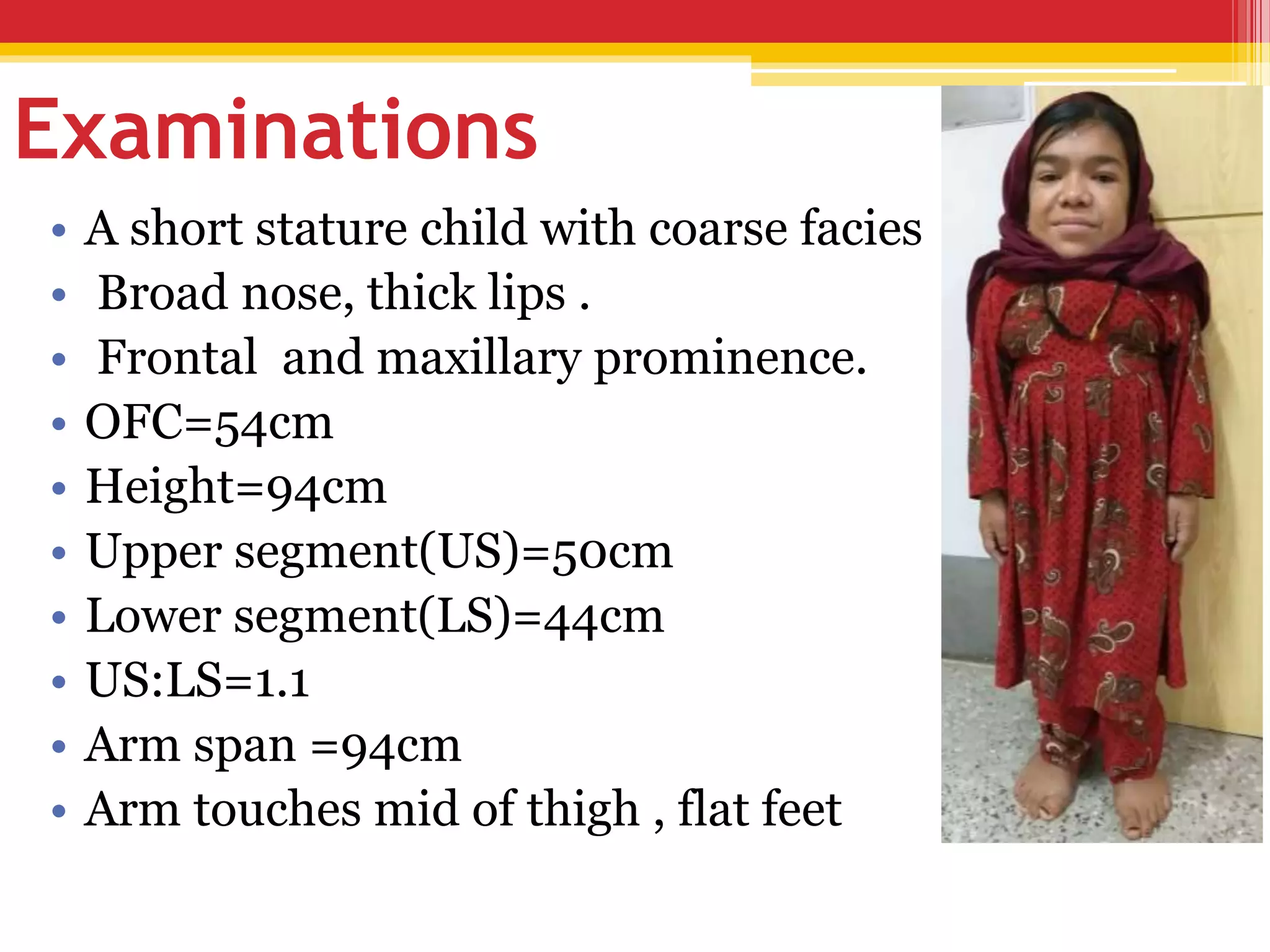 Case presntation of Mucopolysaccharidoses | PPT