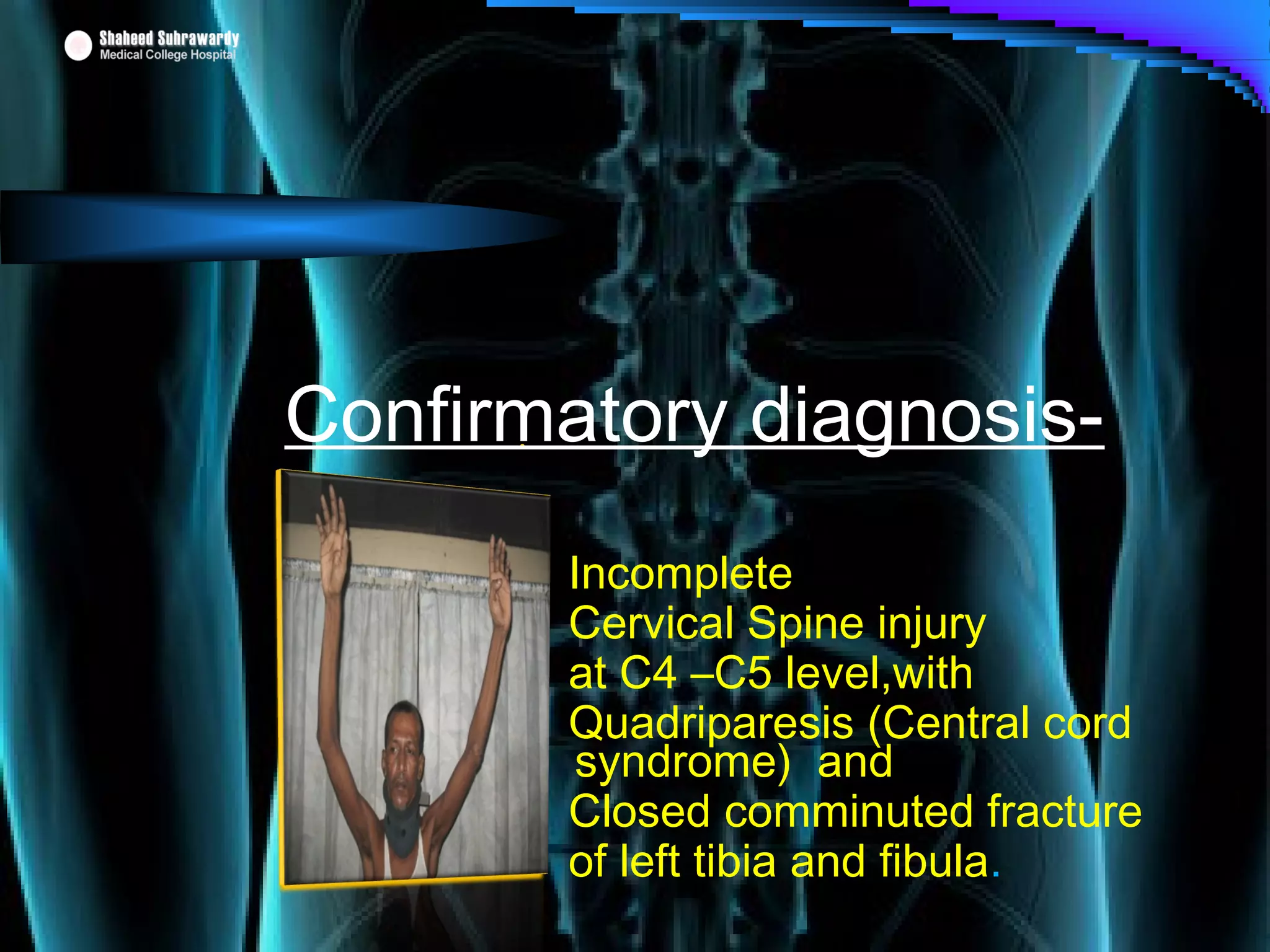 SPINAL TRAUMA/ INJURY: CASE PRESENTATION- WEAKNESS OF LIMBS FOLLOWING ...