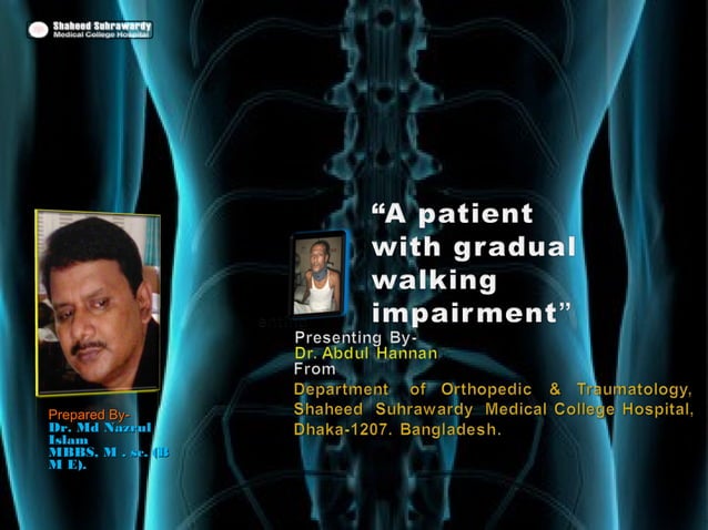 SPINAL TRAUMA/ INJURY: CASE PRESENTATION- WEAKNESS OF LIMBS FOLLOWING ...