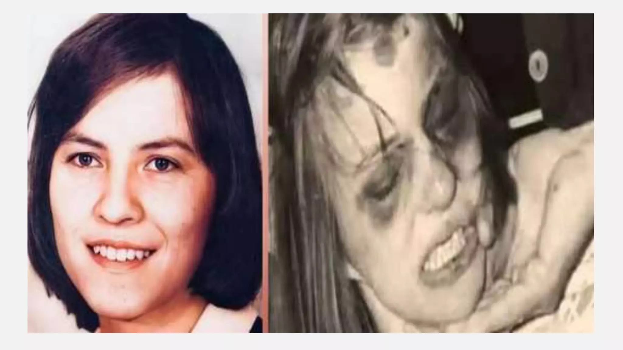(medical explanation) Emily rose, exorcism of Anneliese Michel.pptx