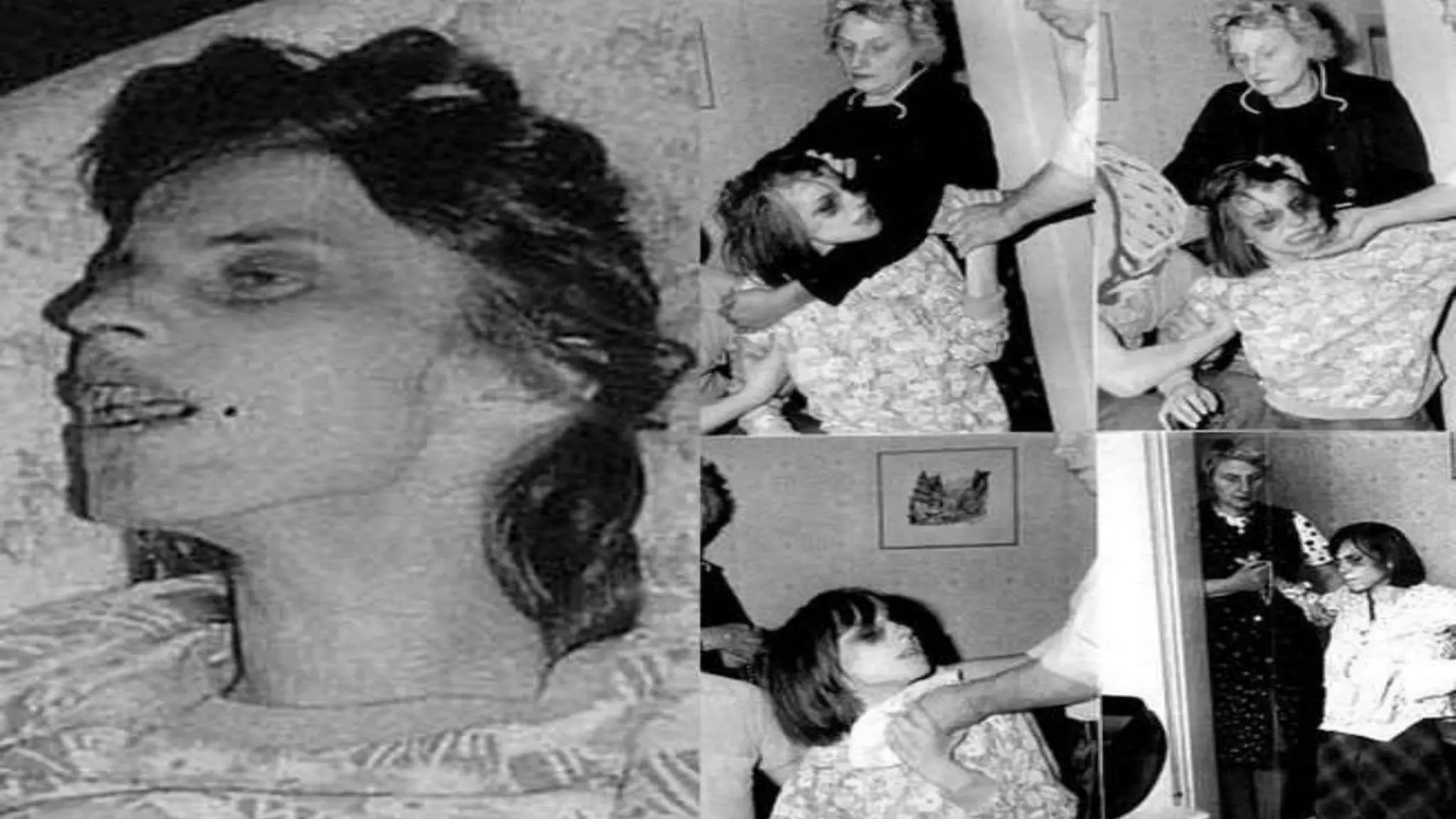 (medical explanation) Emily rose, exorcism of Anneliese Michel.pptx