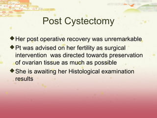Case Report:Massive Ovarian Cyst in a Adolescent Girl | PPT