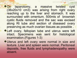 Case Report:Massive Ovarian Cyst in a Adolescent Girl | PPT