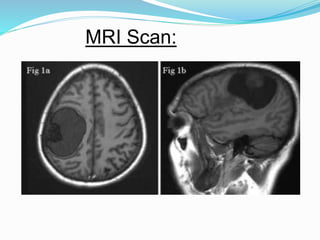 Case Report | PPTX