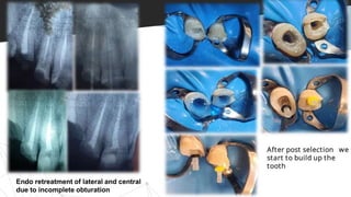 case report by me don't miss it please.ppsx | Free Download