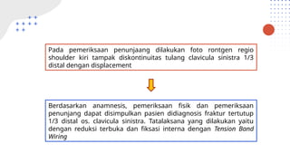 laporan kasus fraktur 1/3 distal clavicula | PPTX