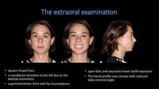 Severe anterior open bite in a Class II hyperdivergent adult patient: A ...