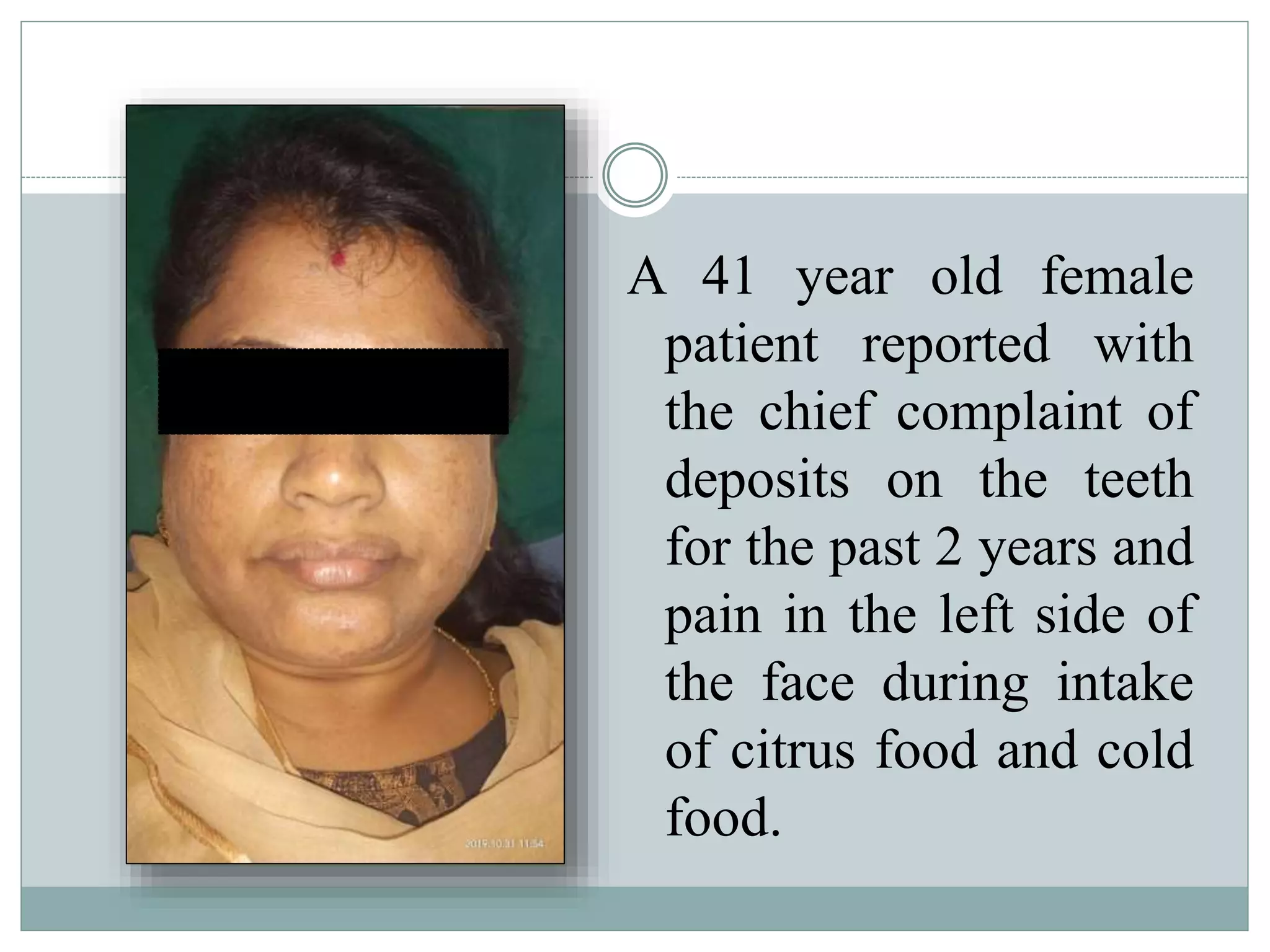 Case report-bilateral parotid swelling with oral submucous fibrosis | PPTX