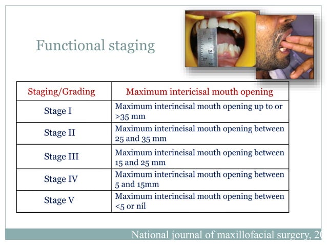 Case report-bilateral parotid swelling with oral submucous fibrosis | PPT
