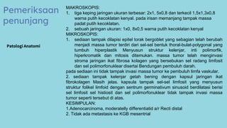 CASE REPORT - CARCINOMA RECTAL tumor.pptx