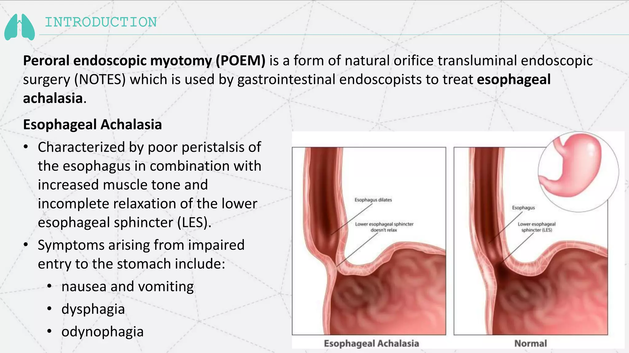 CASE REPORT- Pneumothorax.pptx