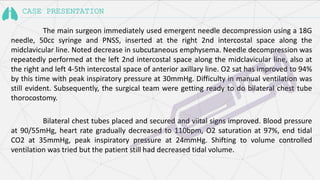 CASE REPORT- Pneumothorax.pptx