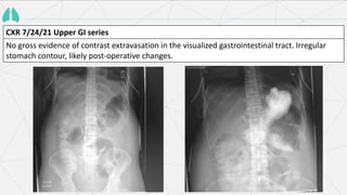 CASE REPORT- Pneumothorax.pptx