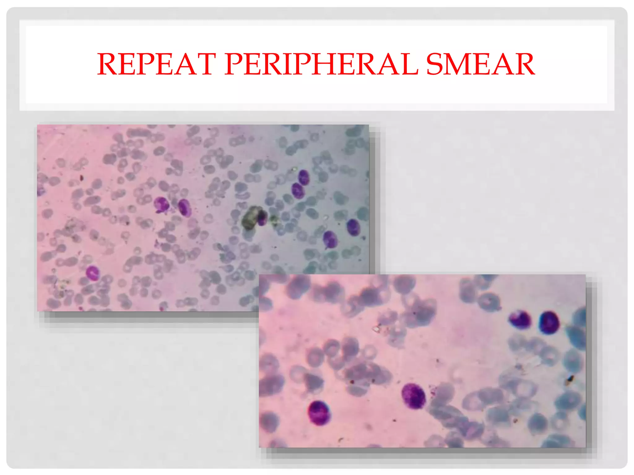 CASE REPORT -SEMINAR APML.pptx