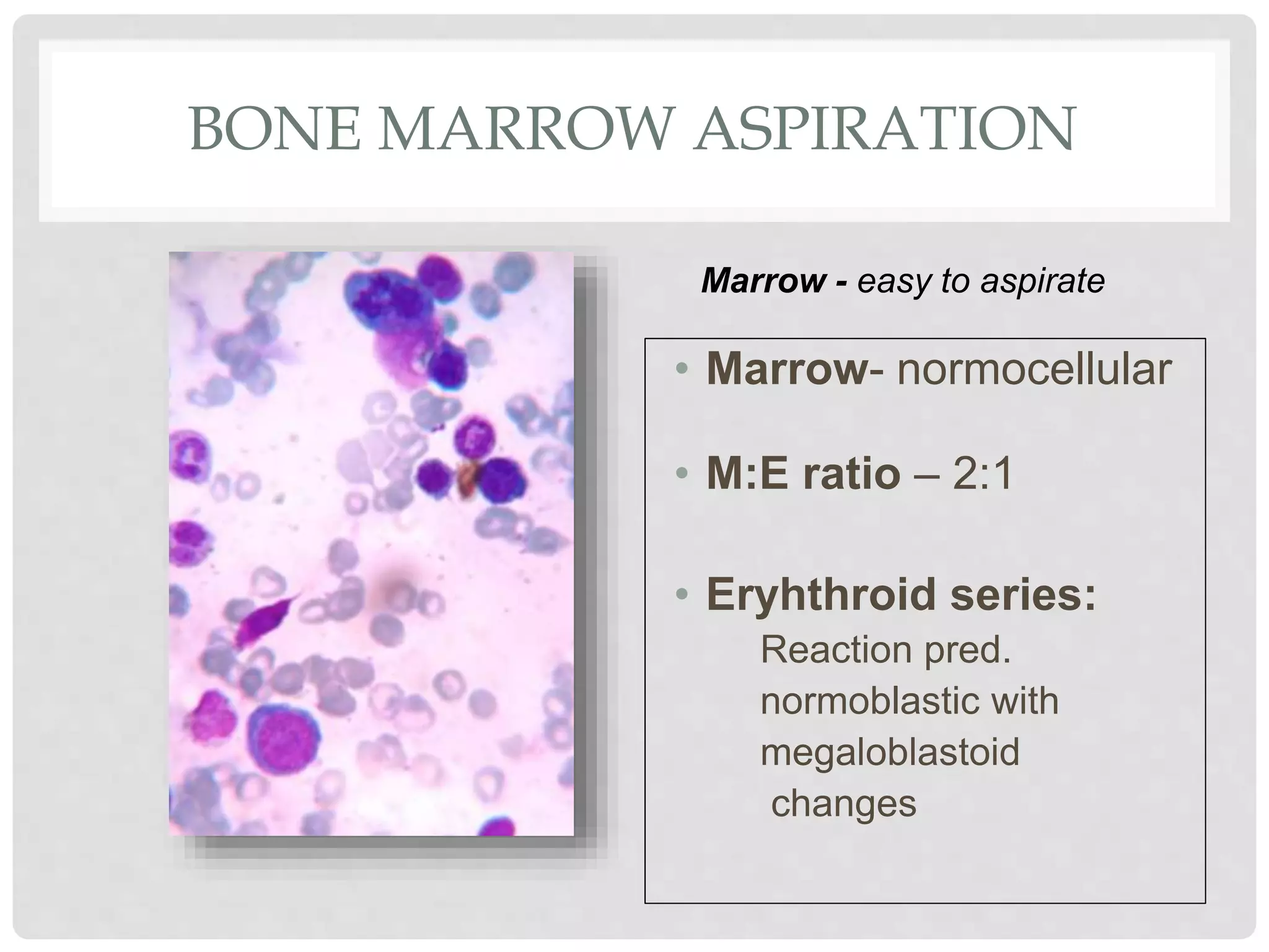 CASE REPORT -SEMINAR APML.pptx