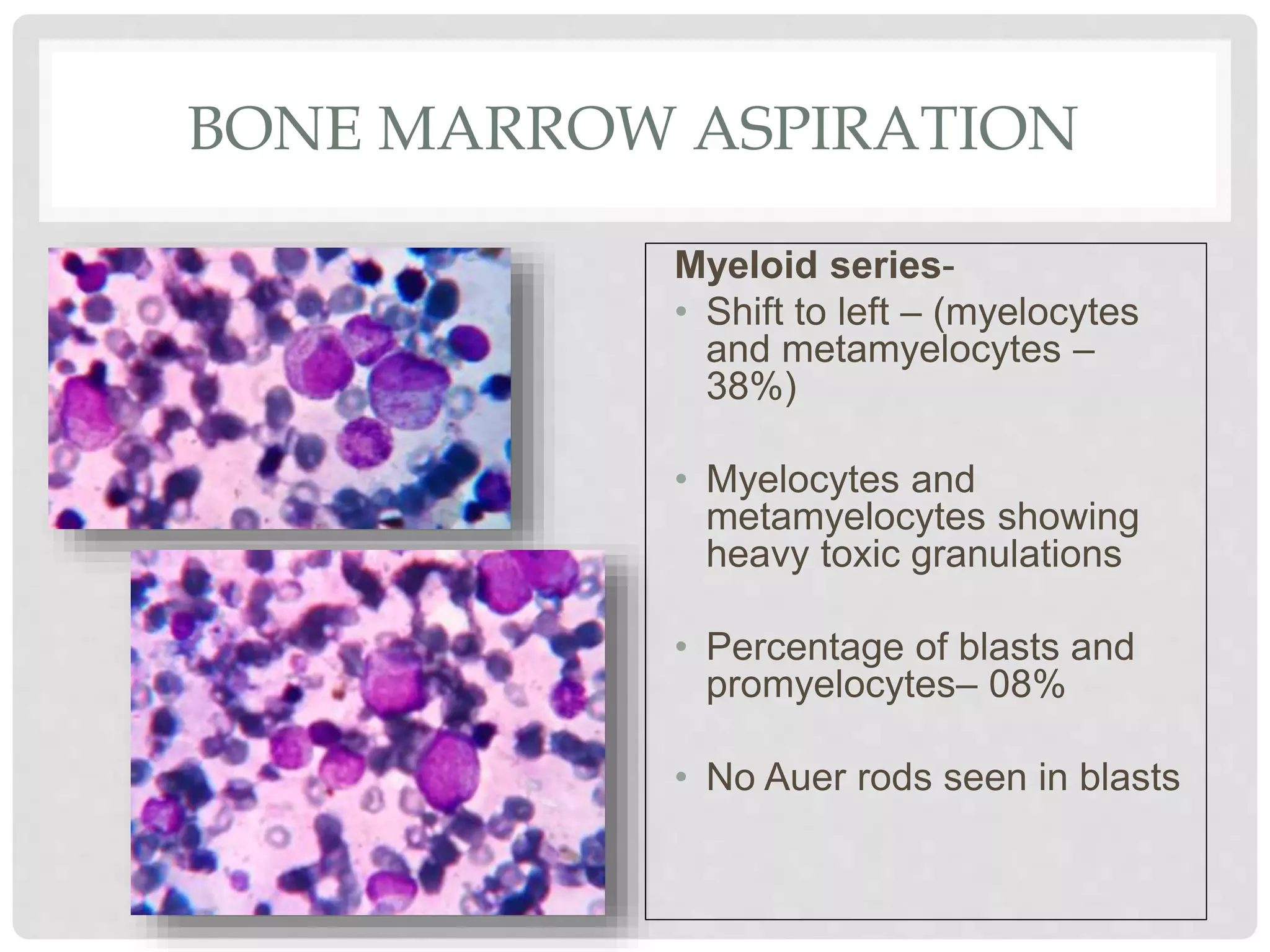 CASE REPORT -SEMINAR APML.pptx