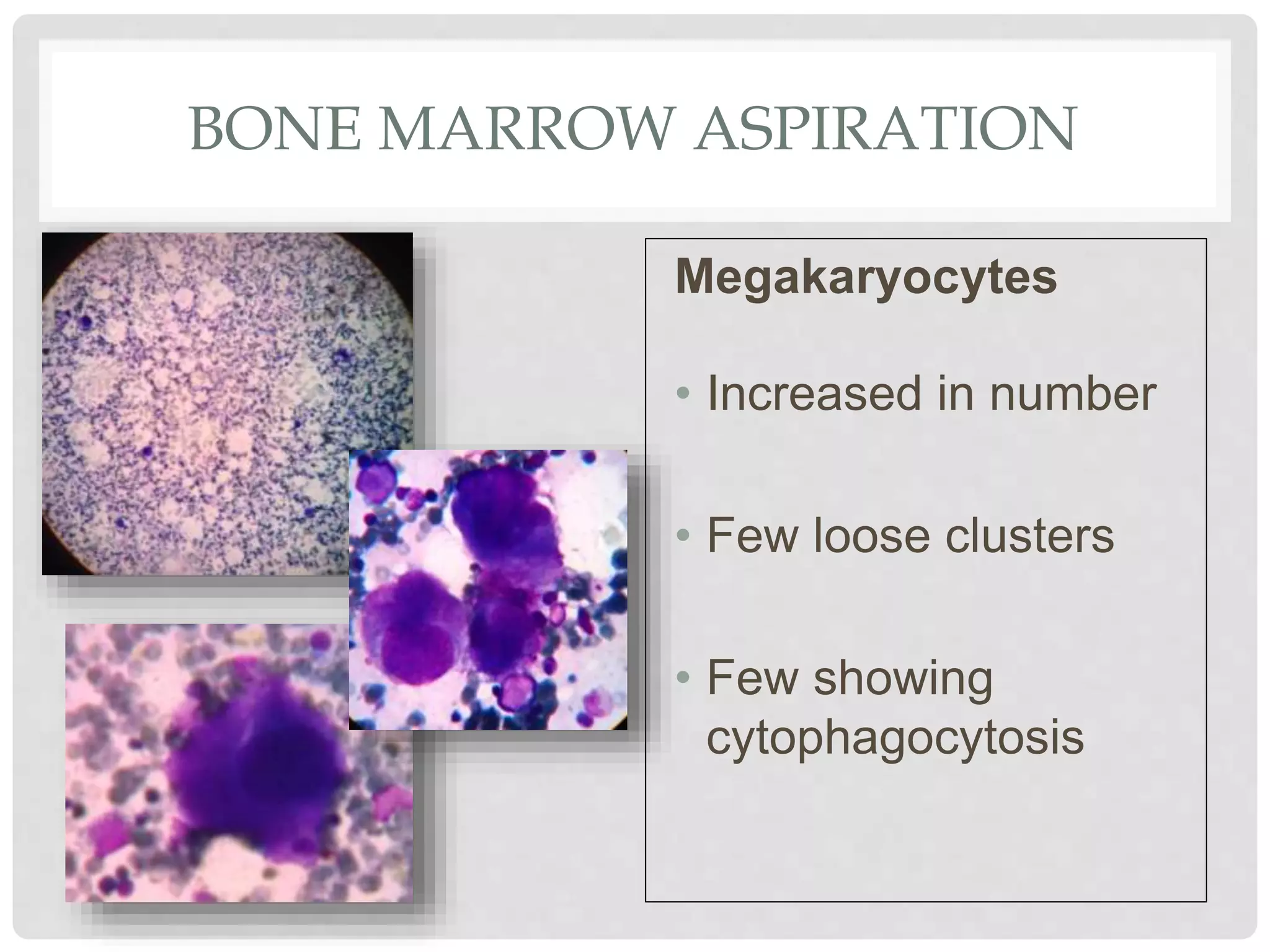 CASE REPORT -SEMINAR APML.pptx