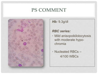 CASE REPORT -SEMINAR APML.pptx