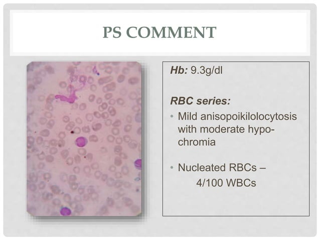 CASE REPORT -SEMINAR APML.pptx