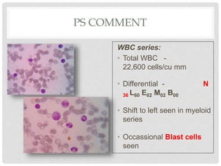 CASE REPORT -SEMINAR APML.pptx