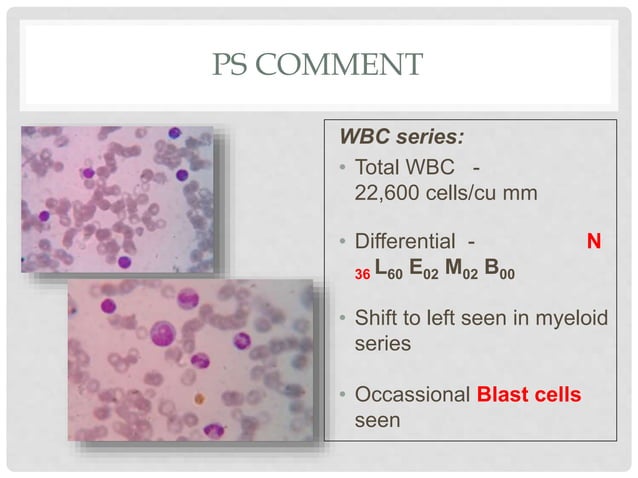 CASE REPORT -SEMINAR APML.pptx