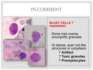 CASE REPORT -SEMINAR APML.pptx