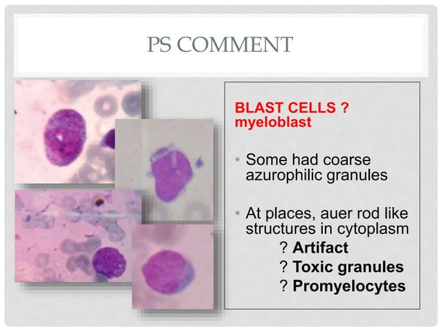 CASE REPORT -SEMINAR APML.pptx