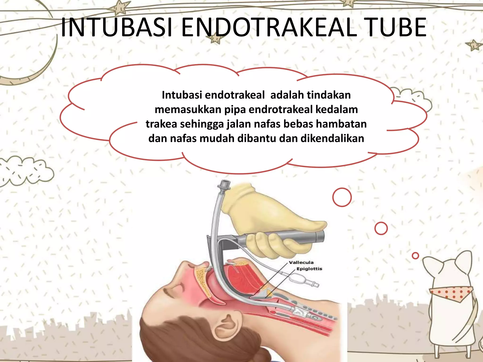 Case Report Anestesi.pptx