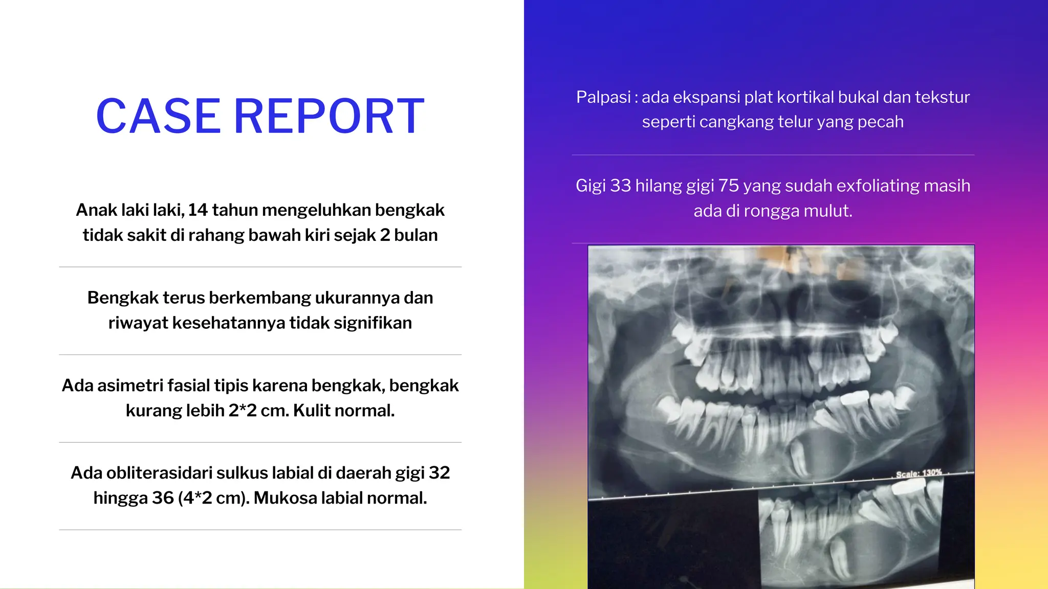 CASE REPORT BEDAH MULUT - ADENOMATOID.pdf