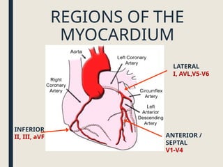 CARDIO STEMI CASE REPORT (STEMI ANTEROSEPTAL ONSET 11 HOURS, KILLIP I ...