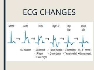 CARDIO STEMI CASE REPORT (STEMI ANTEROSEPTAL ONSET 11 HOURS, KILLIP I ...