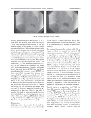 Percutaneous Transvenous Mitral Commissurotomy in 71 Years Old Woman ...