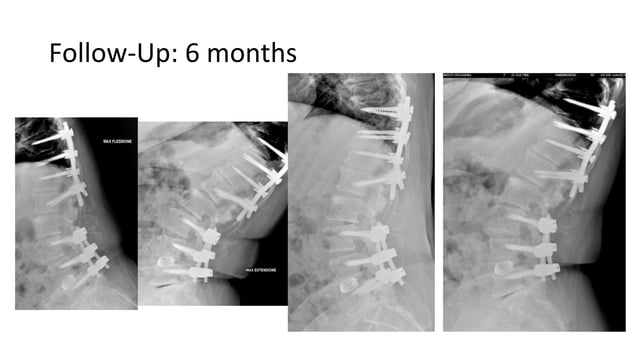 case report follow up | PPTX