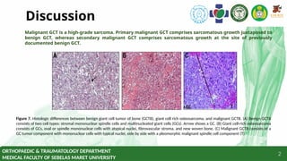 a Case Report GCT Talocalcaneal on women | PPT | Free Download