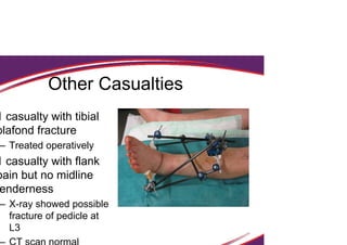 Case report of thoracic spine fractures from ied blast in armoured ...