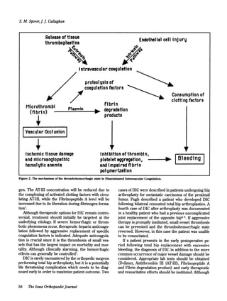 Case Report On Dic & Dvt | PDF | Blood Disorders | Diseases and Conditions