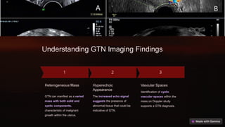 Case Report on Invasive Mole. Gestational Trophoblastic Neoplasia (GTN ...