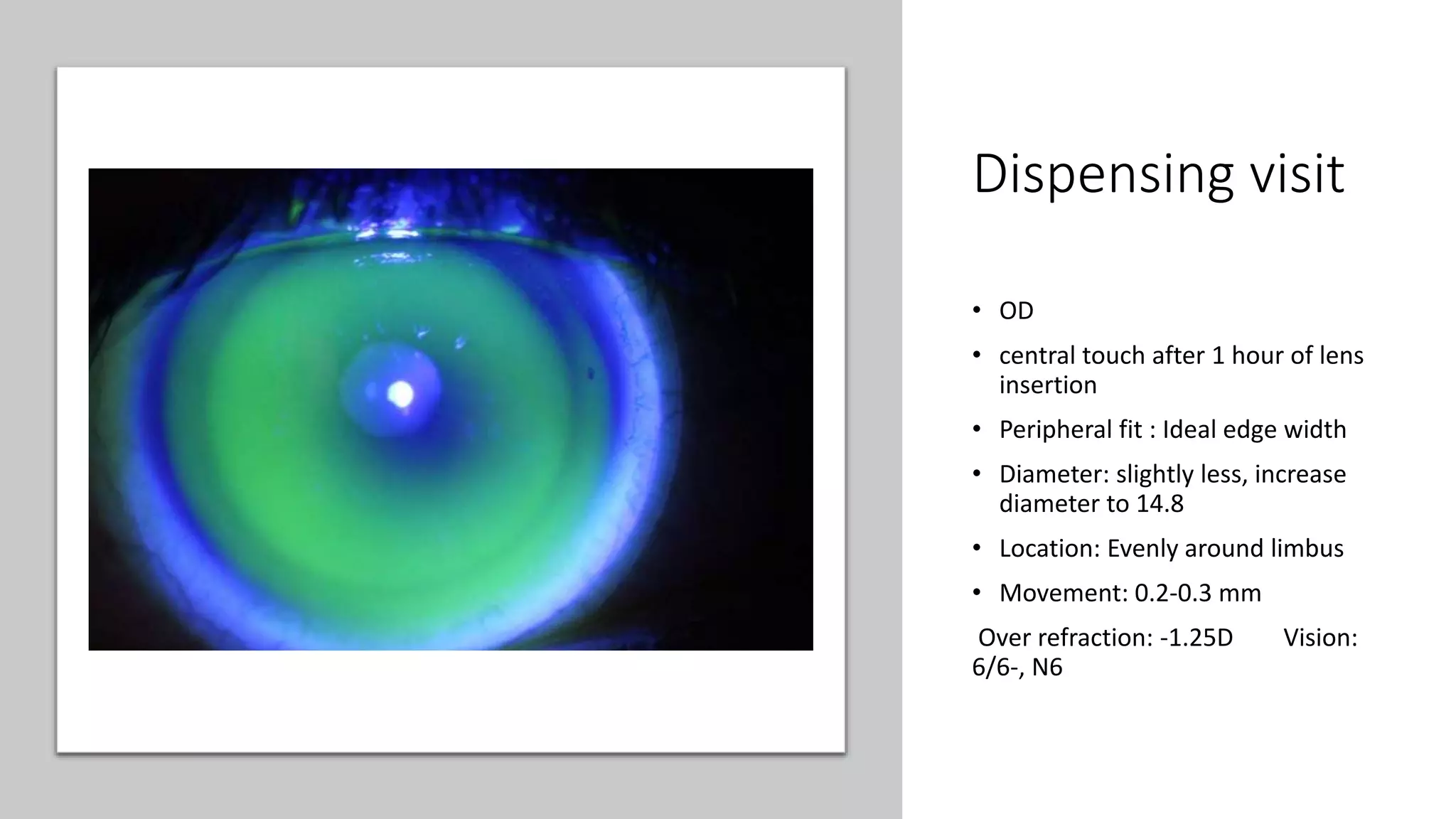 Case report on rose k2 xl | PPTX