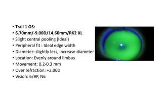 Case report on rose k2 xl | PPTX