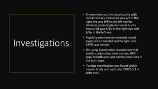 Case report on soft toric cl fitting | PPT