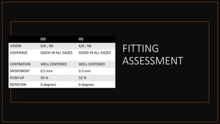 Case report on soft toric cl fitting | PPTX