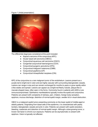 Case Report Pyogenic Granuloma - Website.pdf