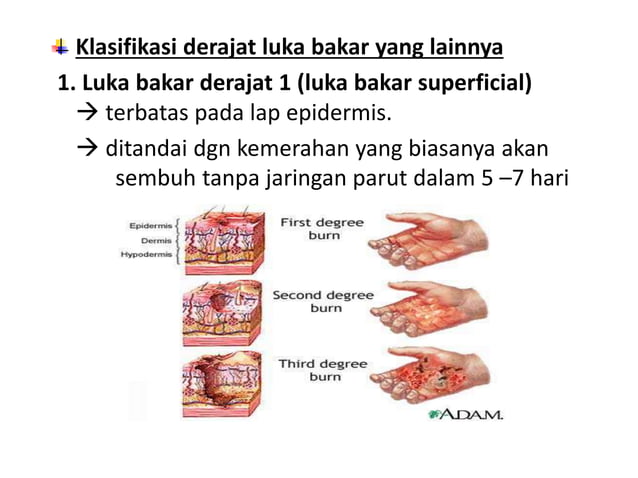 Case Report Session Skin Combustion | PPTX