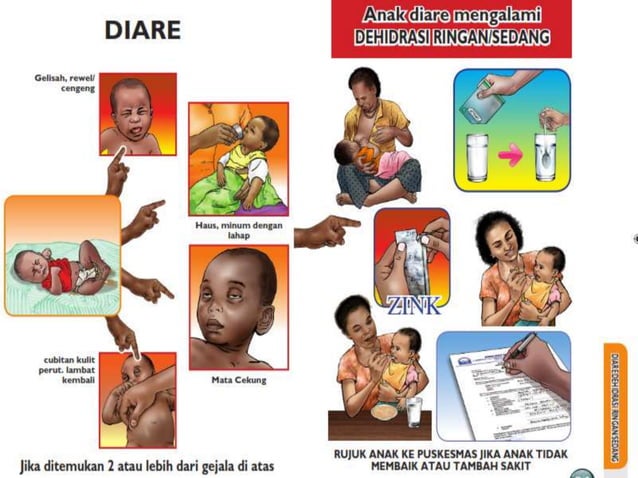 Case Report diare Akut Dehidrasi Ringan Sedang ppt | PPTX